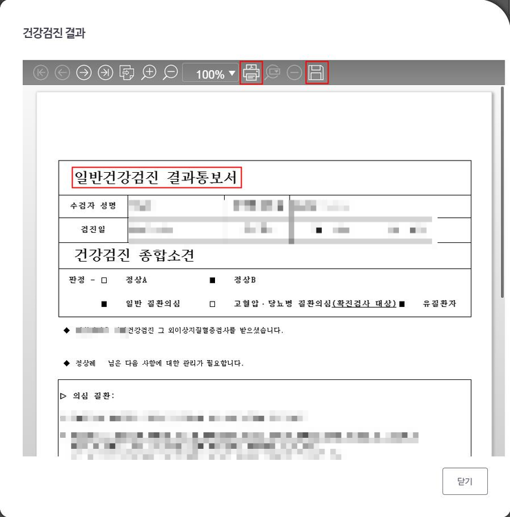 건강검진 결과 조회 및 언제 나오는지 국민건강보험 건강검진표 수령 방법 변경 과 결과통보서 발급 방벙 알아보기 확인검사